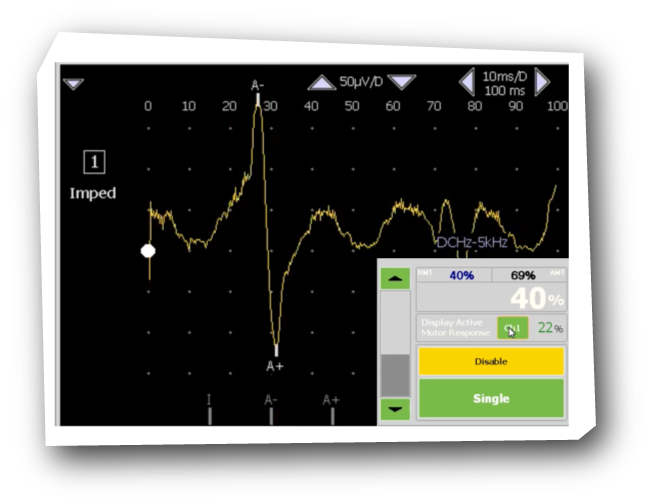DuoMAG XT TMS System | Brainbox